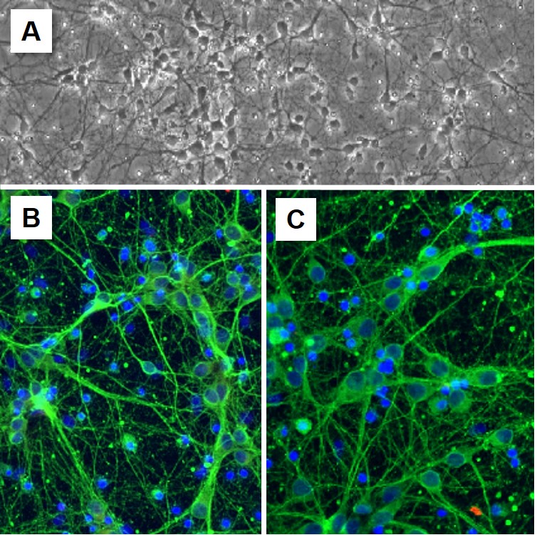 RCoN | Primary Rat Cortical Neurons | Cell Applications